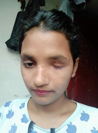 Victim of stone pelting at train seeks financial assistance - The Hitavada